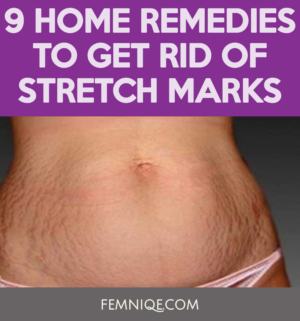 How To Get Rid Of Stretch Marks Butt Thigh Hips Femniqe How To Get Rid Of Stretch Marks Butt Thigh Hips Femniqe